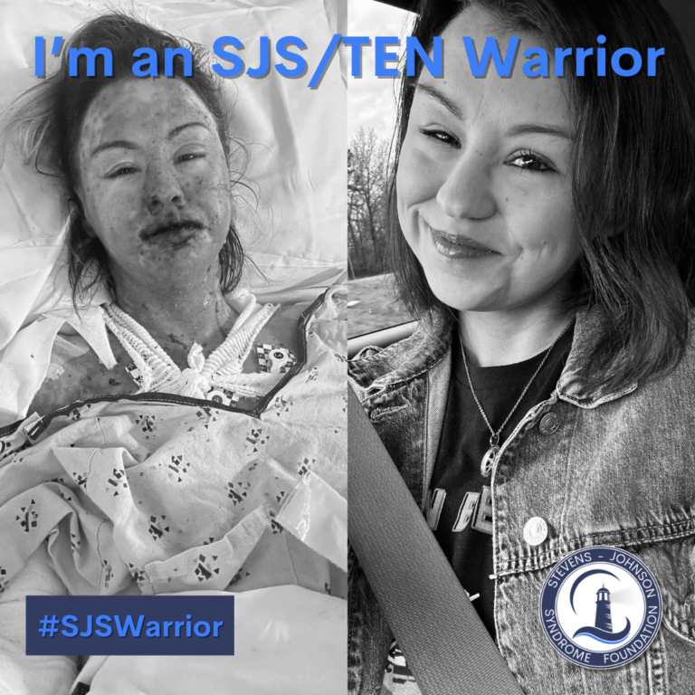 Meet Our SJS Warriors – Stevens-Johnson Syndrome Foundation