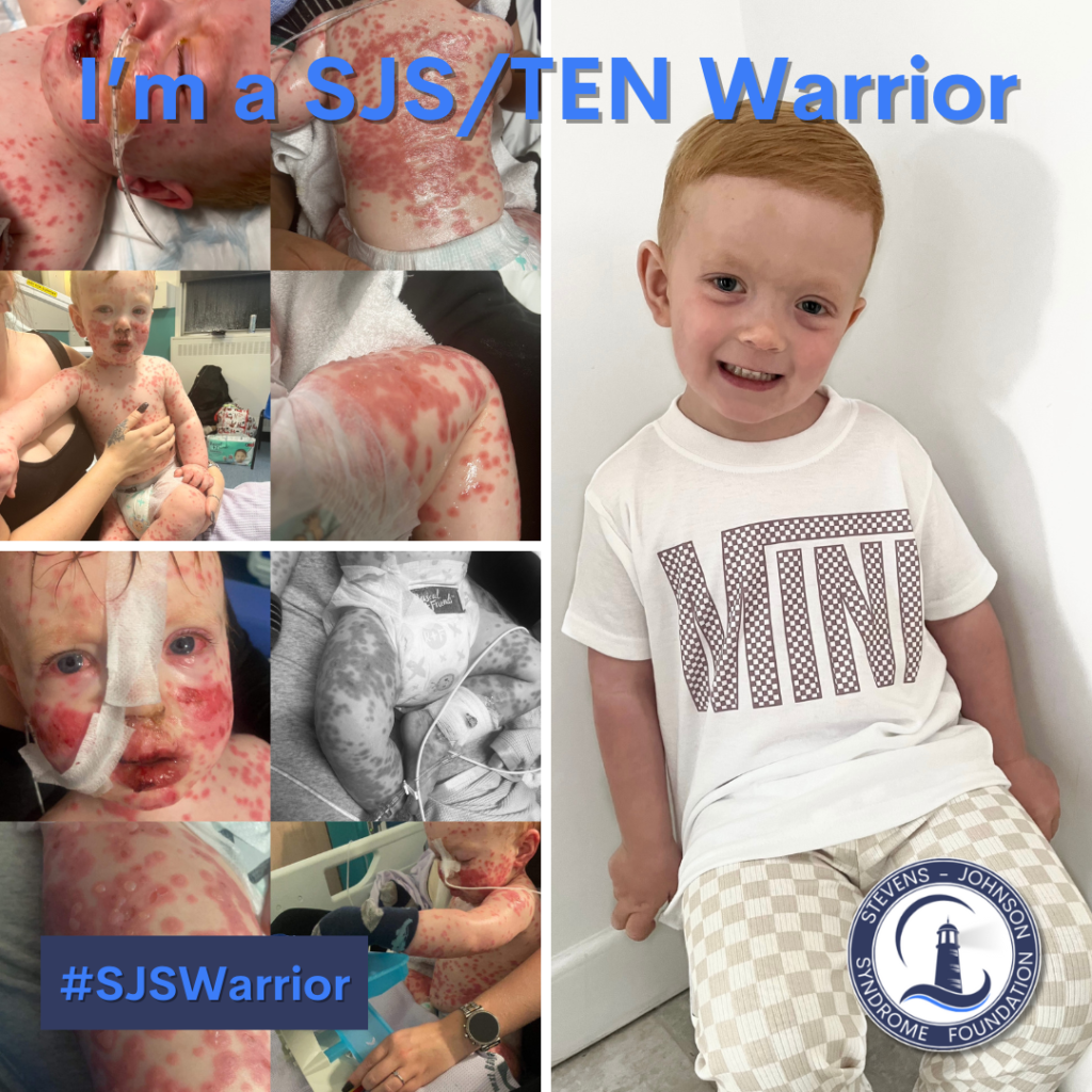 Meet Our SJS Warriors – Stevens-Johnson Syndrome Foundation