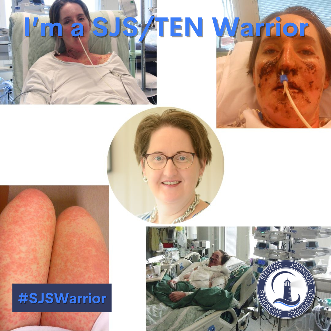 Meet Our SJS Warriors – Stevens-Johnson Syndrome Foundation