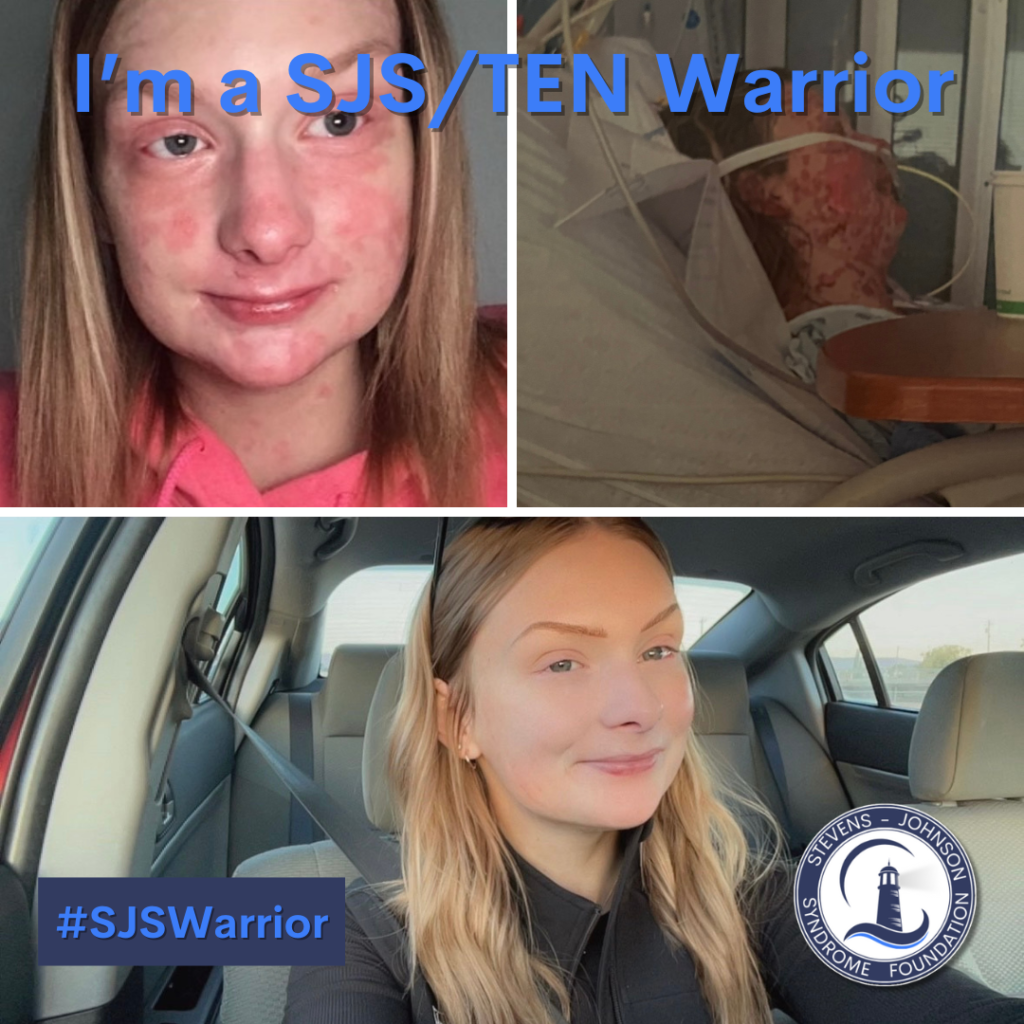 Meet Our SJS Warriors – Stevens-Johnson Syndrome Foundation
